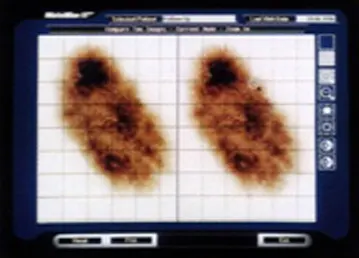 Welcome to The Skin Mole Clinic - Mole Clinic Joondalup, mole check ...